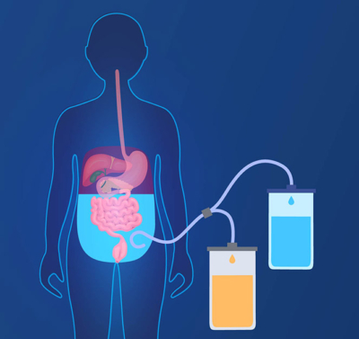 All about kidney disease | The Ottawa Hospital Foundation