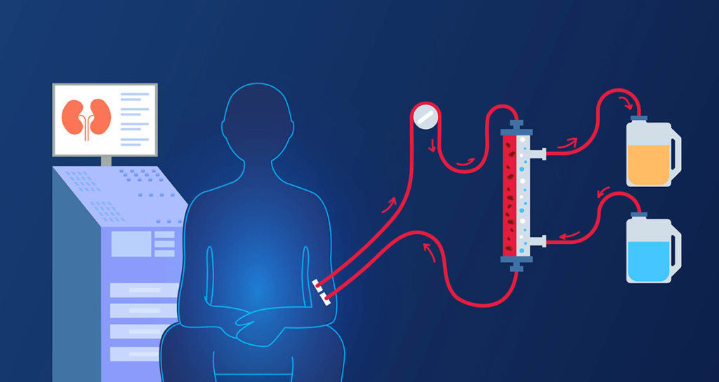 All about kidney disease | The Ottawa Hospital Foundation