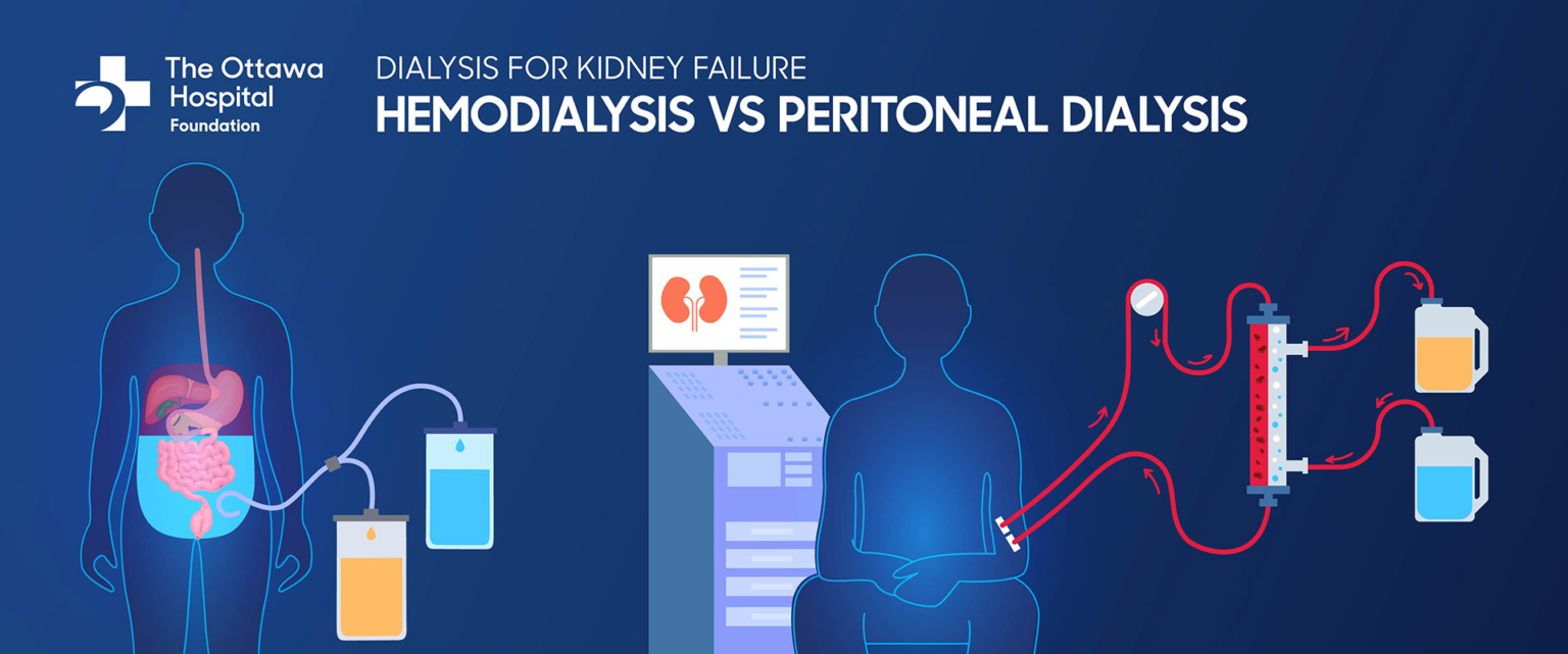 All about kidney disease | The Ottawa Hospital Foundation