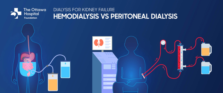 All about kidney disease | The Ottawa Hospital Foundation