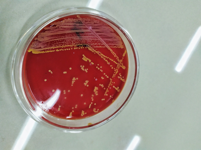 All about strep A | The Ottawa Hospital Foundation
