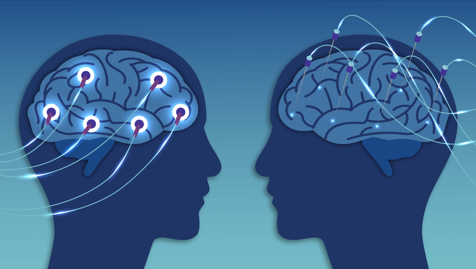 First-ever stereo EEG procedure at The Ottawa Hospital for epilepsy ...