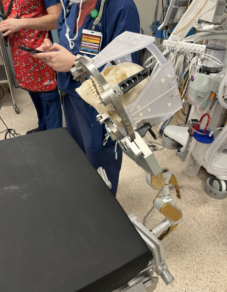 First-ever stereo EEG procedure at The Ottawa Hospital for epilepsy ...